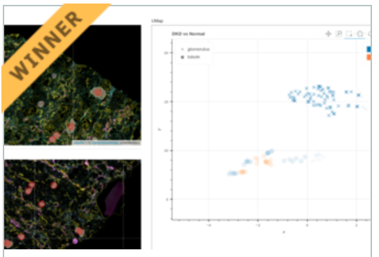 NanoString Spatial Omics Hackathon: Help scientists accelerate spatial discoveries by building ...